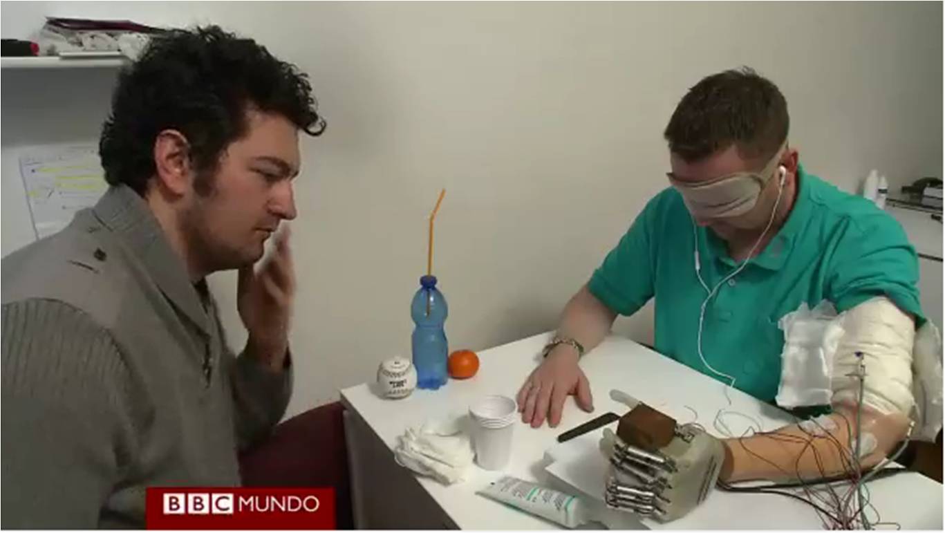 VIDEO: La primera mano biónica con sentido del tacto - DiarioRepublica.com