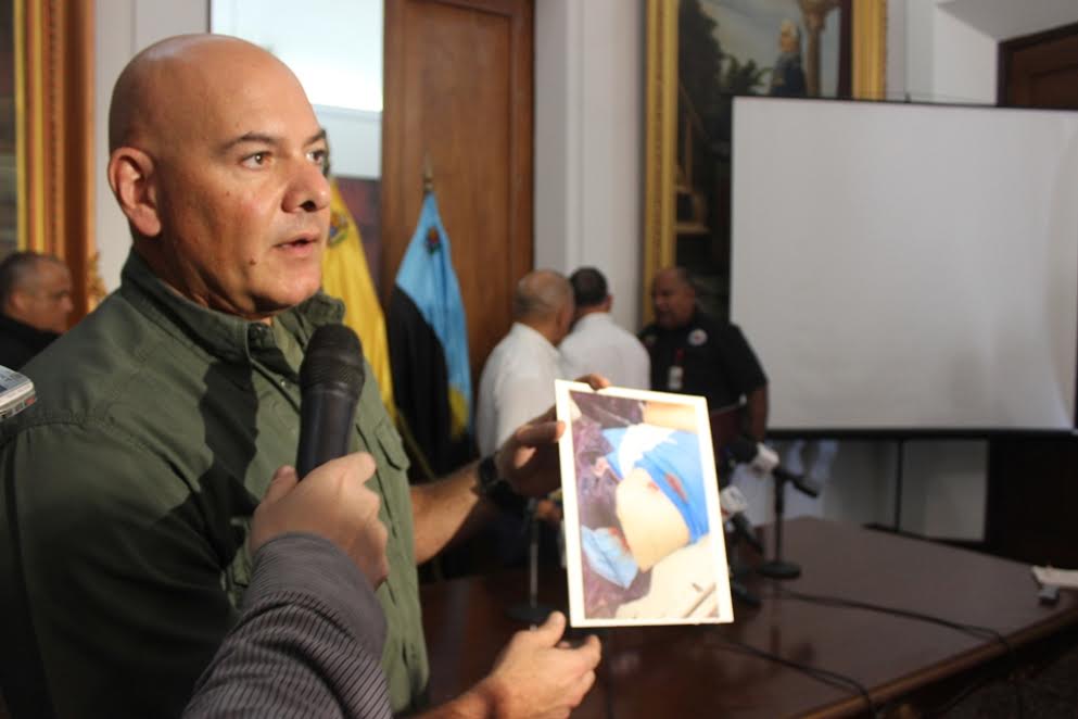 CICPC confirman que metra disparada de arma casera produjo la muerte ...