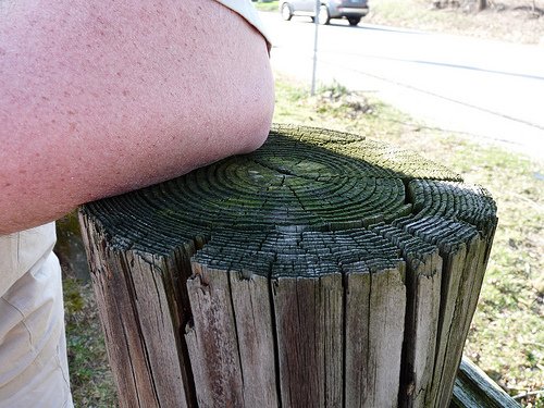 ¿Codos secos y agrietados? Suavizalos de manera rápida con estos ...